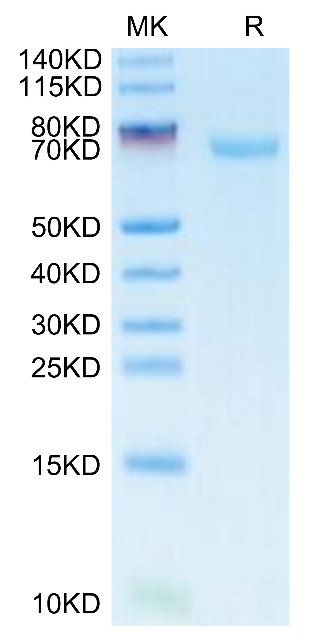 FITC-Labeled Human B7-H3/CD276 Protein, Accession: Q5ZPR3 - Jiangsu ...